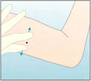 Implanon: Bula original, extraída manualmente da Anvisa | CR